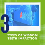 3 Types of Wisdom Teeth Impaction - Tulsa Precision Dental
