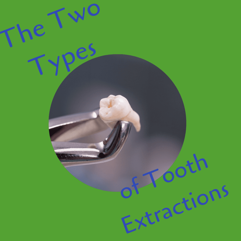 The 2 Types of Tooth Extractions - Tulsa Precision Dental